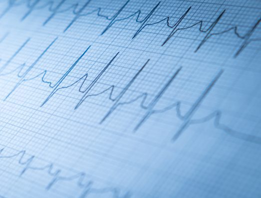 Non-Invasive Testing Rock Hill, SC | Carolina Cardiology Associates